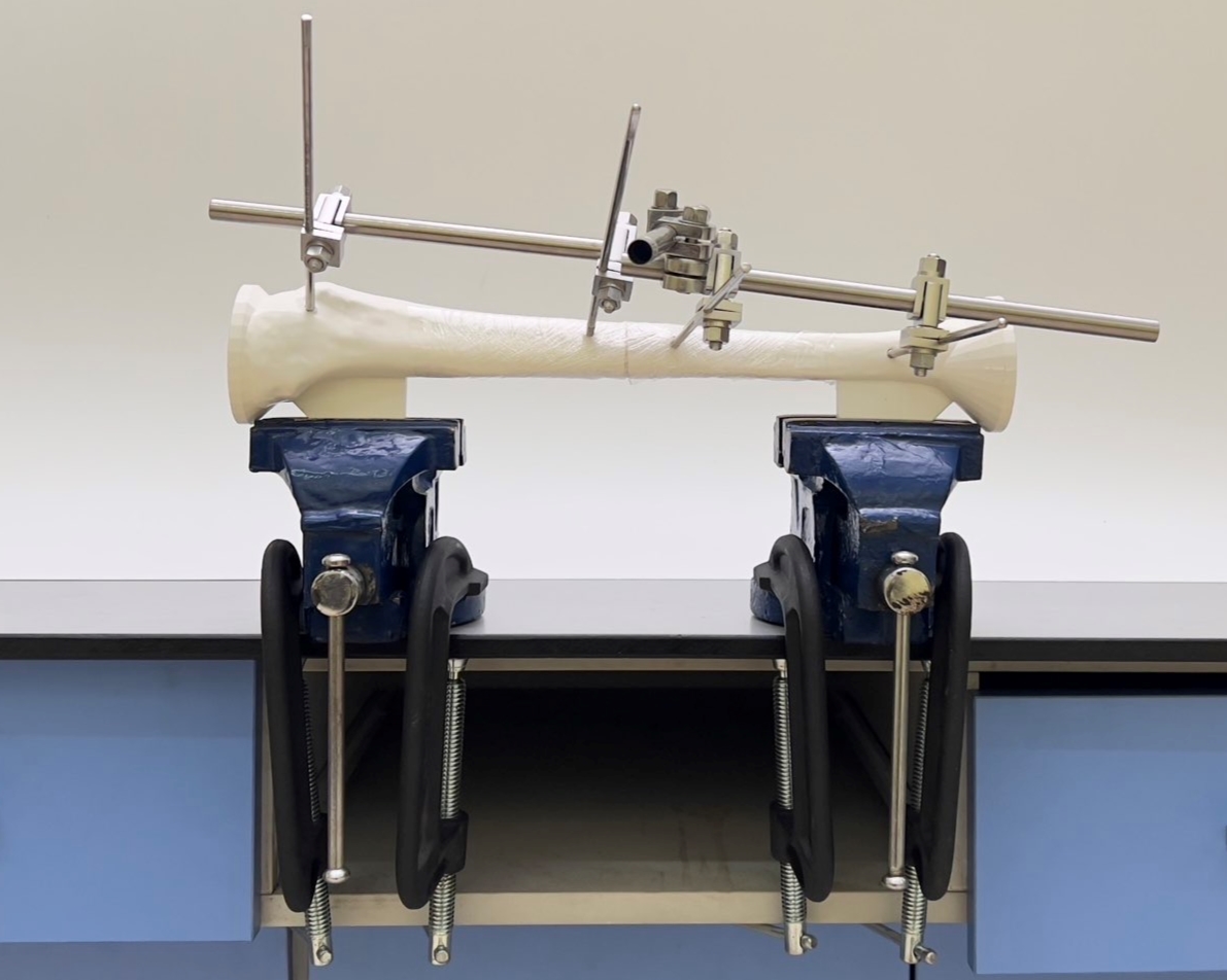 TFF Awarded Runner-up for Tibial Fracture Fixation Training - Global ...